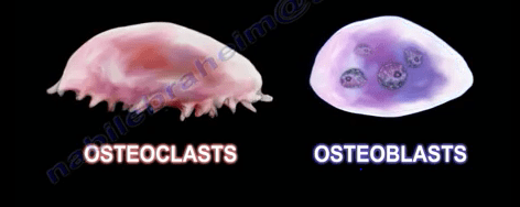 Osteoclasts - medicine Nabil Ebraheim Healthcare