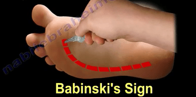 Conditions Affecting the Cervical Spine - Orthopedic Su...