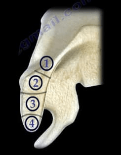 The Acromion - Healthcare bones Orthopaedics Orthopedic...
