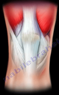 Quadriceps Tendon Rupture - Healthcare medicine quadric...