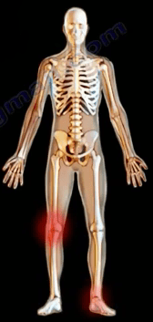 Reiter's Syndrome - medicine Healthcare Nabil Ebraheim