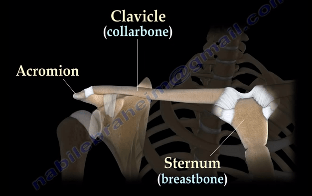Sternocalvicular Joint Dislocations - collarbone disloc...