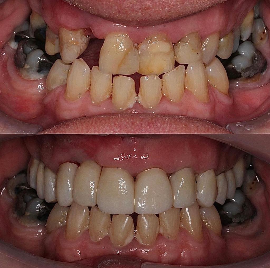 Universal Dental Laboratory