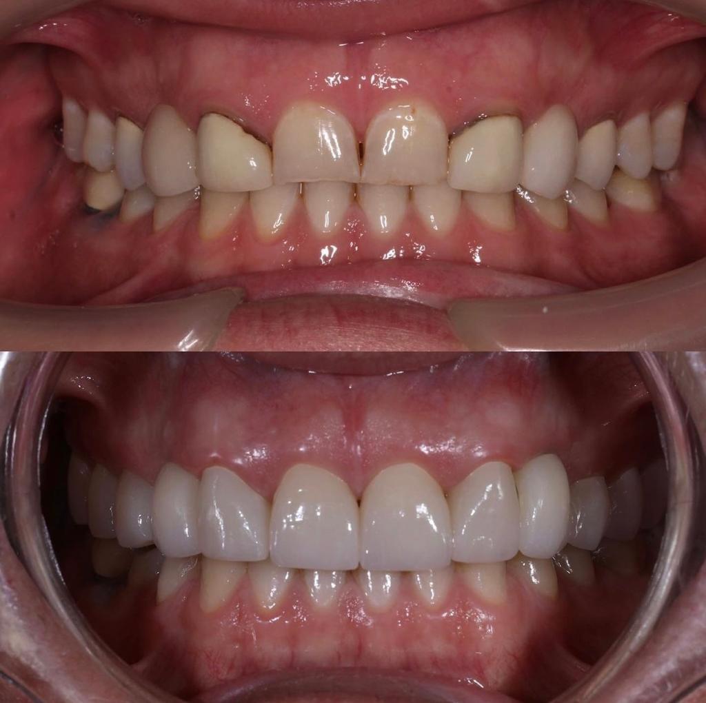 Universal Dental Laboratory