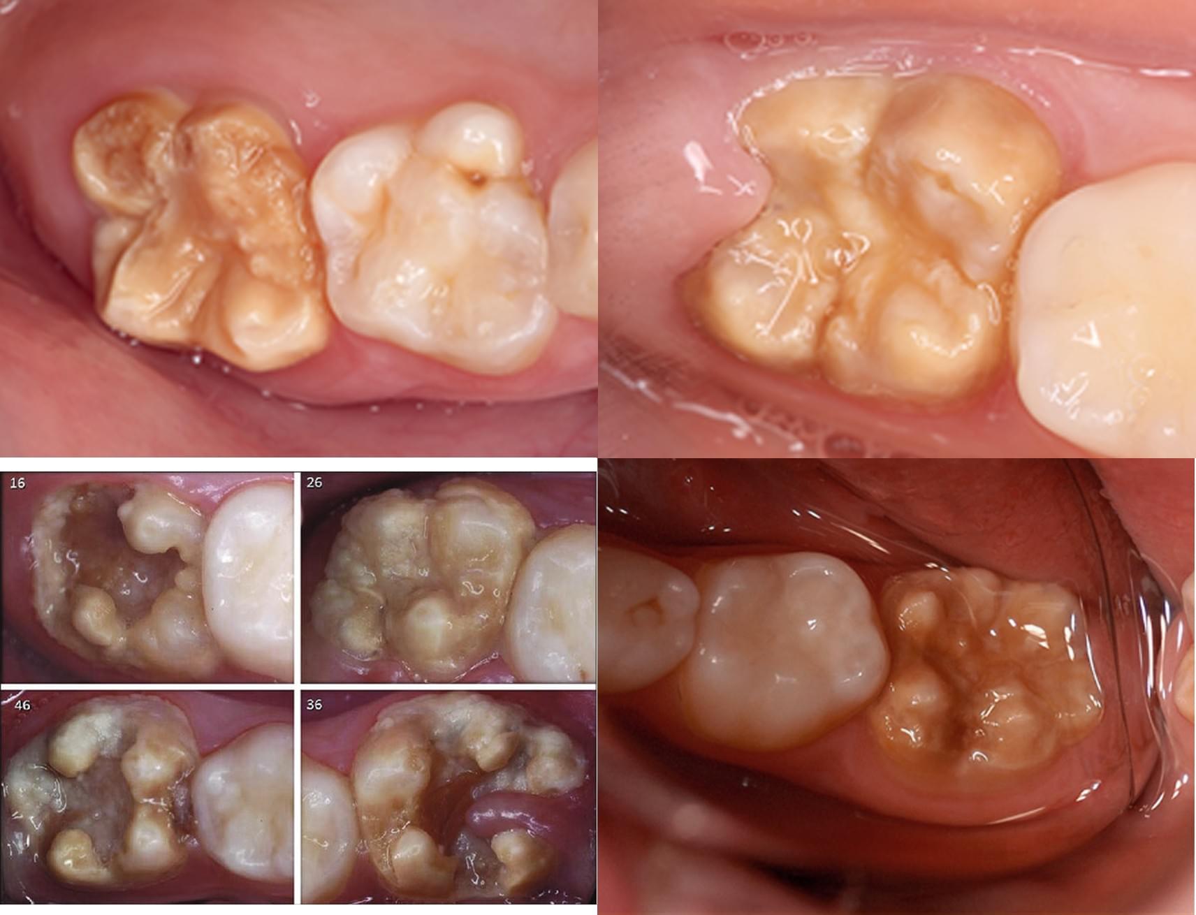 Dentisterie pédiatrique