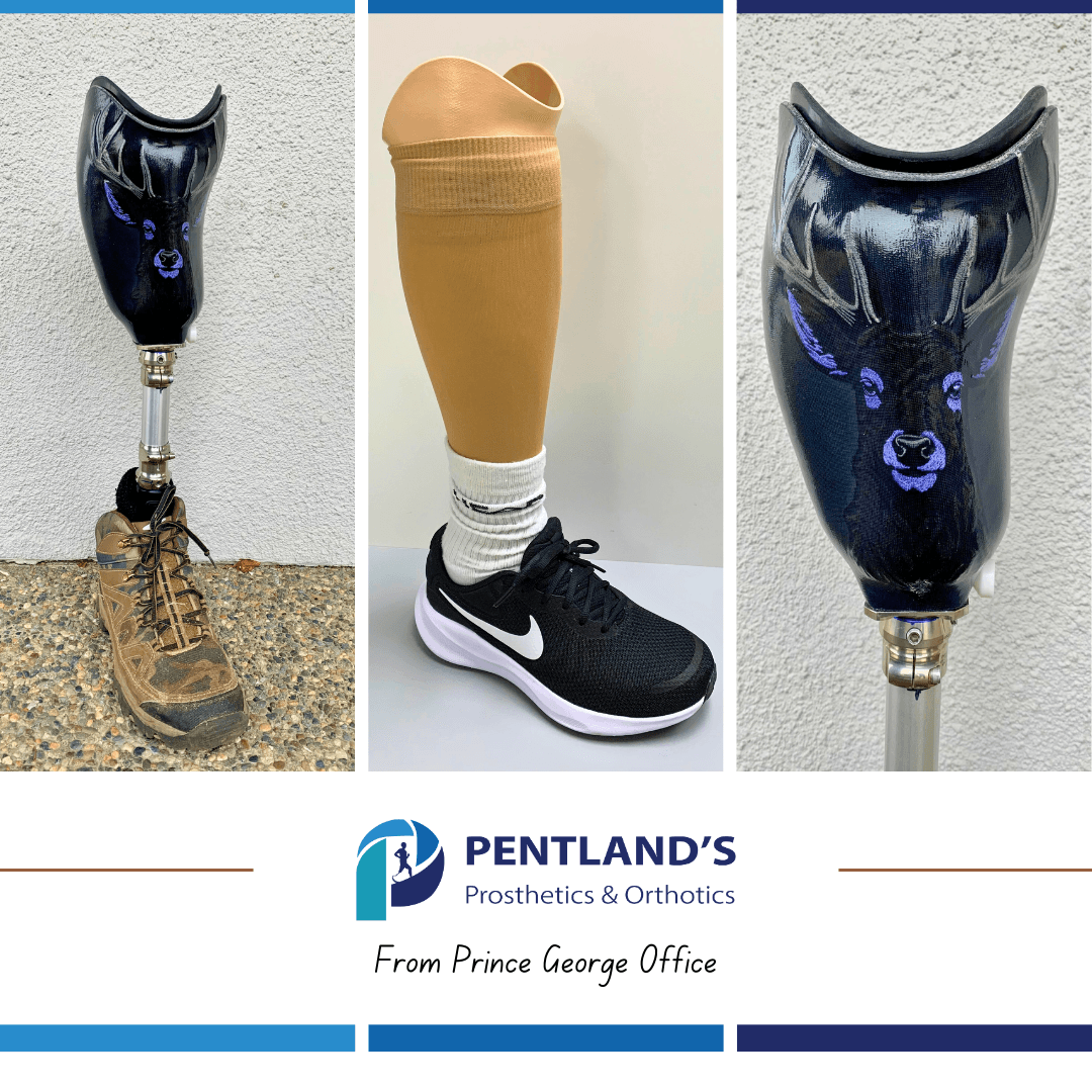 Clinic Gallery | Pentland's Prosthetics & Orthotics Clinic | Inspiring Client Stories